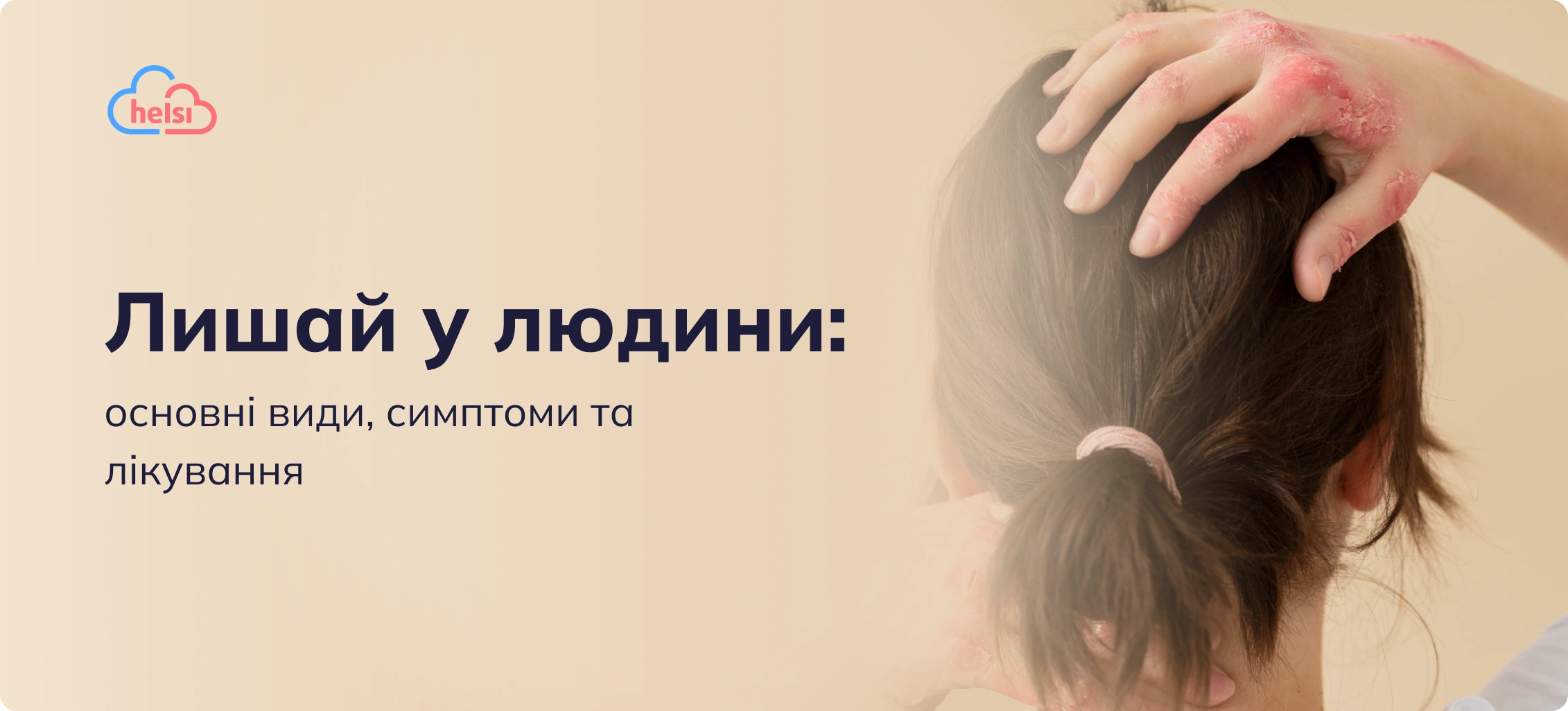 HELSI.me - електронна медична система для пацієнтів та лікарів