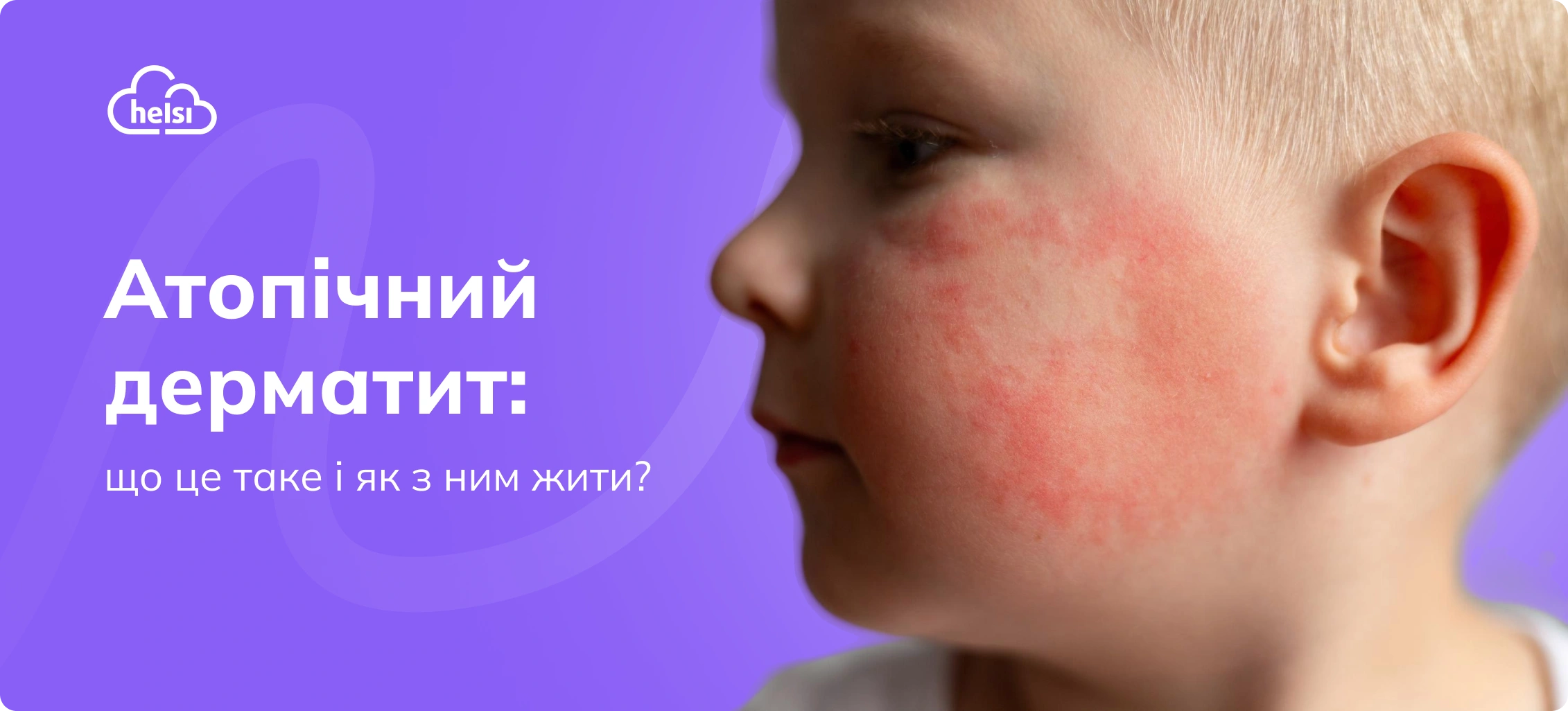 HELSI.me - електронна медична система для пацієнтів та лікарів